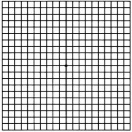 Amsler Grid - Inland Valley Retina
